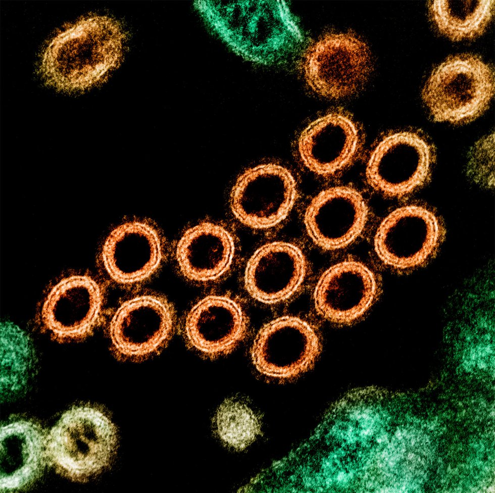 Conviven los virus más infecciosos del mundo - ACN
